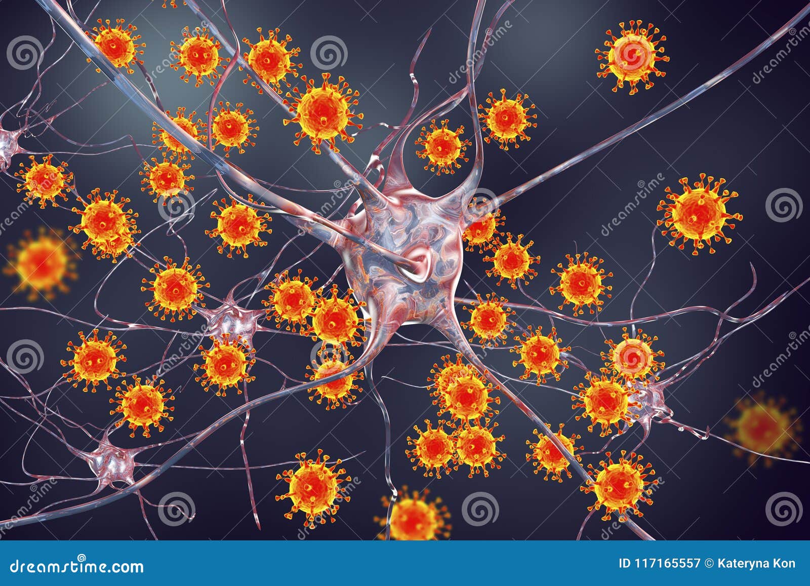 Viruses Infecting Neurons, Concept For Brain Infection Royalty-Free ...