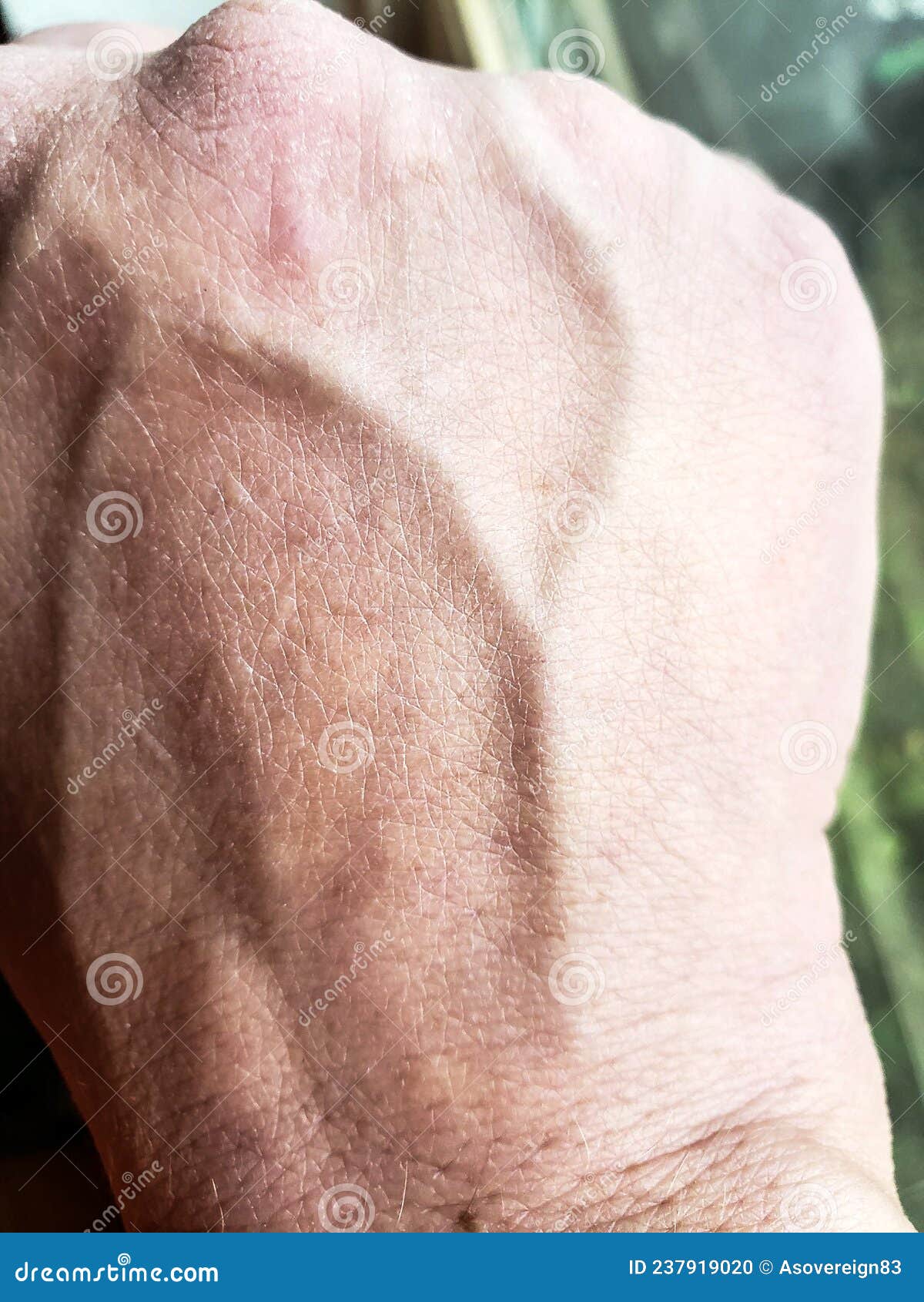 Visible vein on the hand stock photo. Image of dermatology - 237919020
