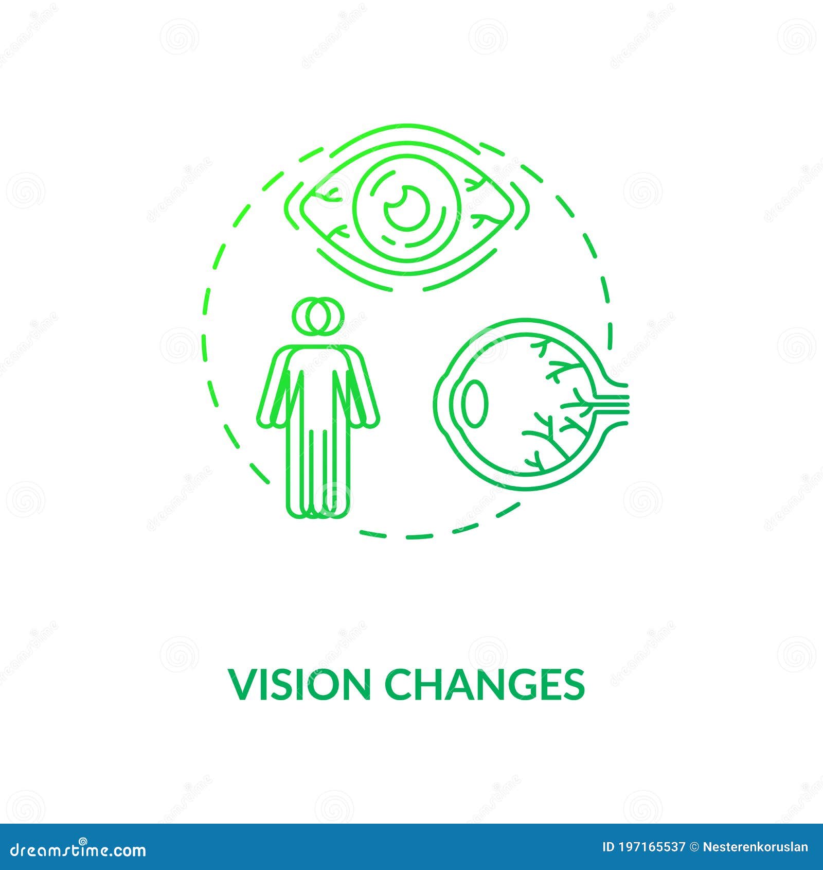 Vision Changes Concept Icon Stock Vector - Illustration of loss ...