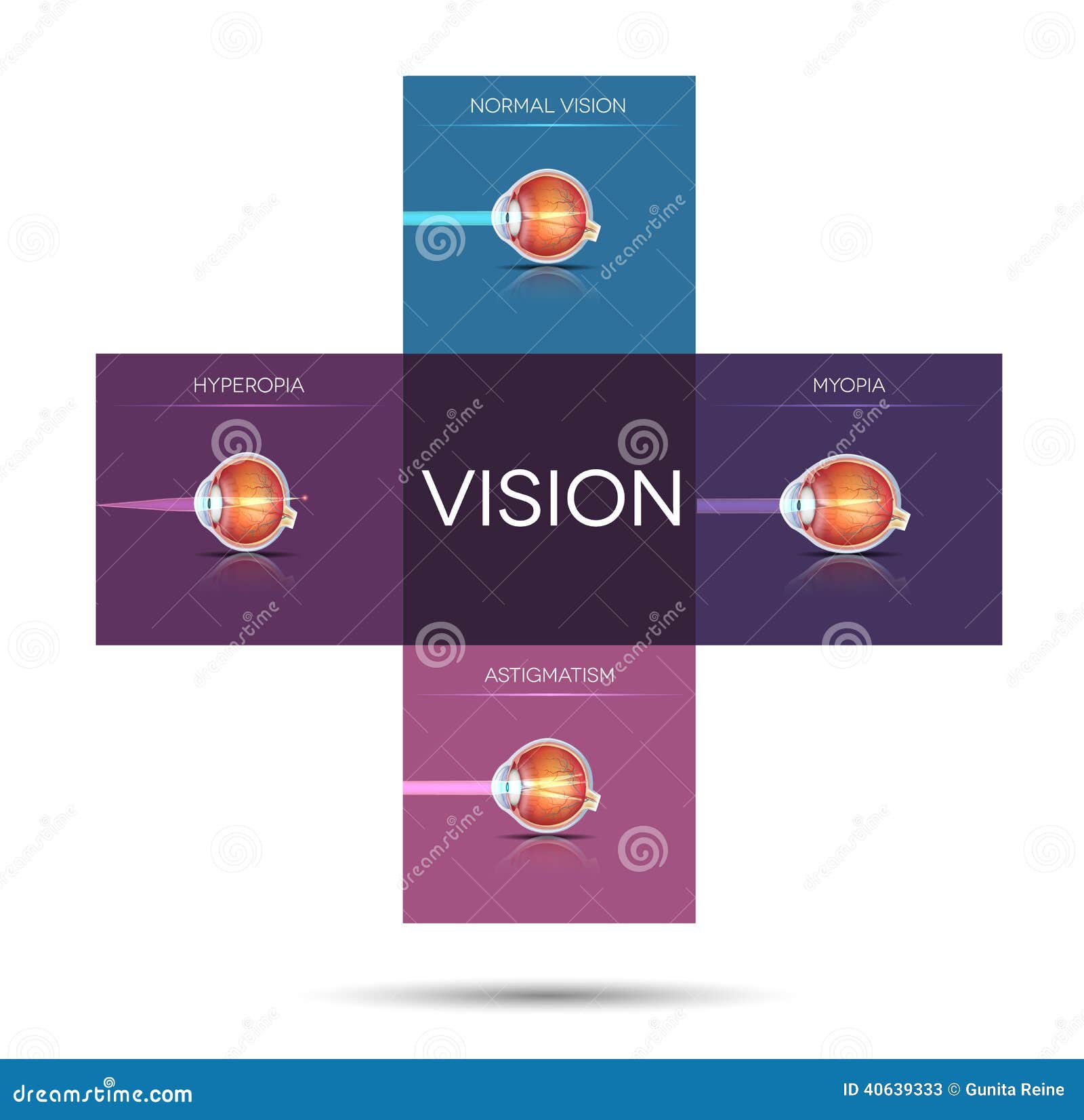 Vision Disorder Artistic Illustration Stock Vector - Illustration of ...