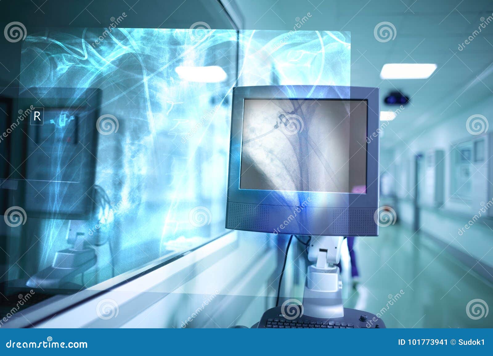Visual Projection of an X-ray Image in the Hospital Stock Image - Image ...