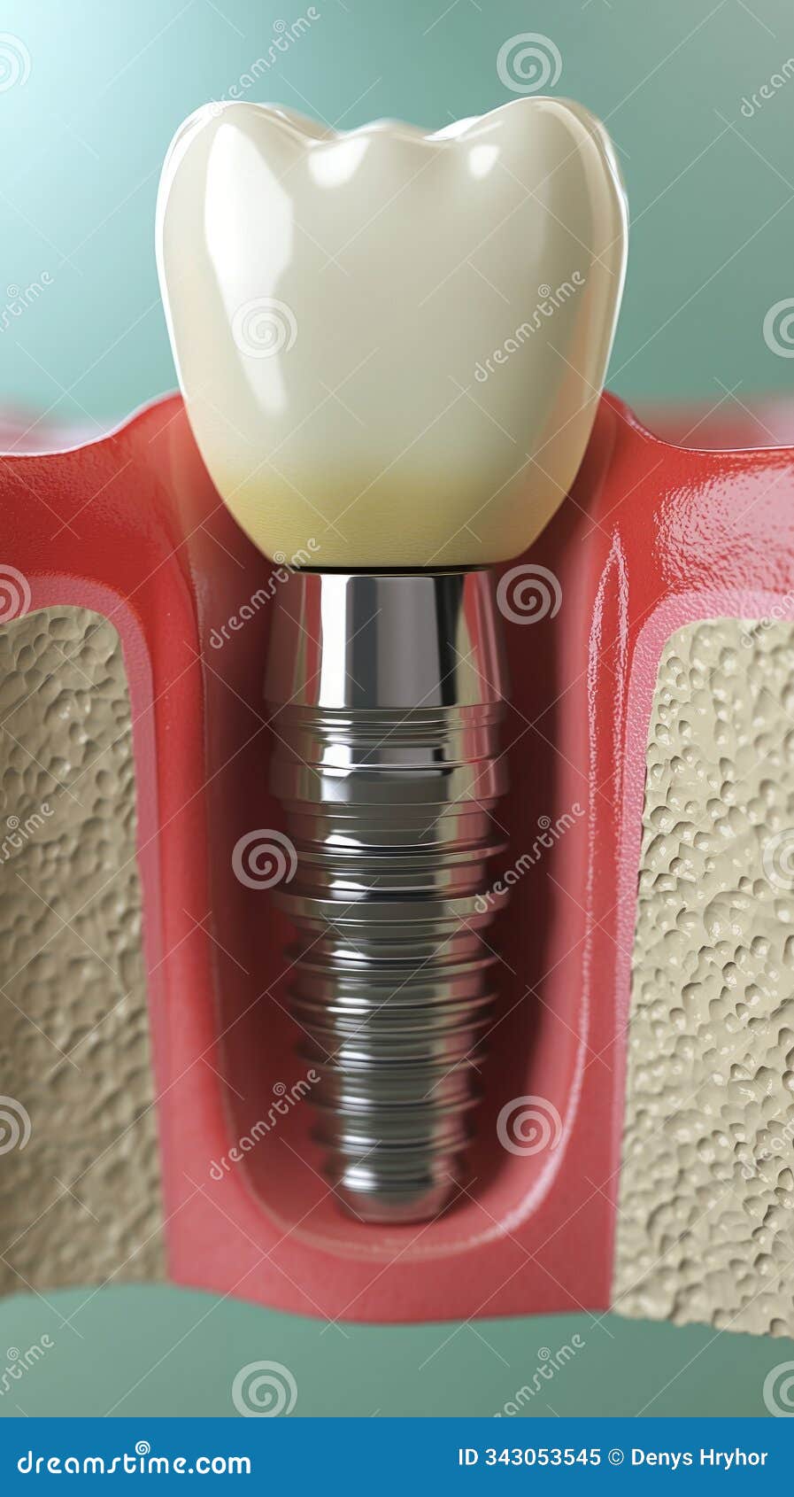 This Visual Representation Illustrates the Components of a Dental ...
