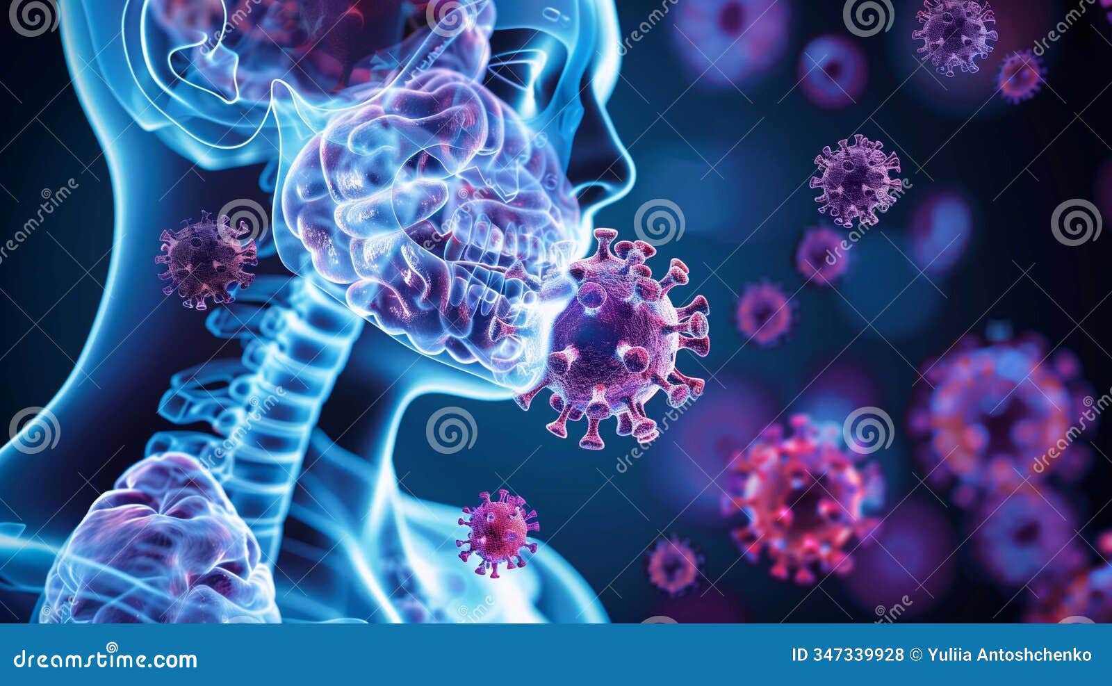 Visual Representation of Respiratory Tract Infections Showing Viruses ...