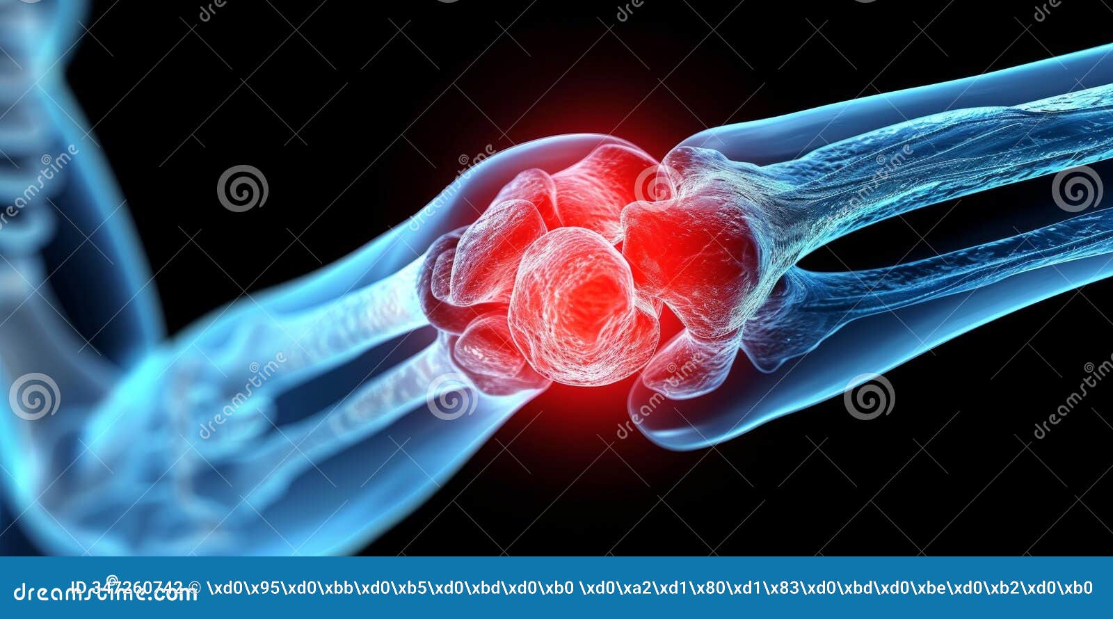 Visualization of Joint Inflammation Highlighting the Anatomical ...