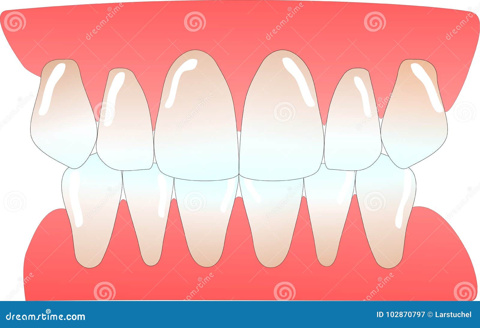 Human anterior teeth stock illustration. Illustration of gingival ...