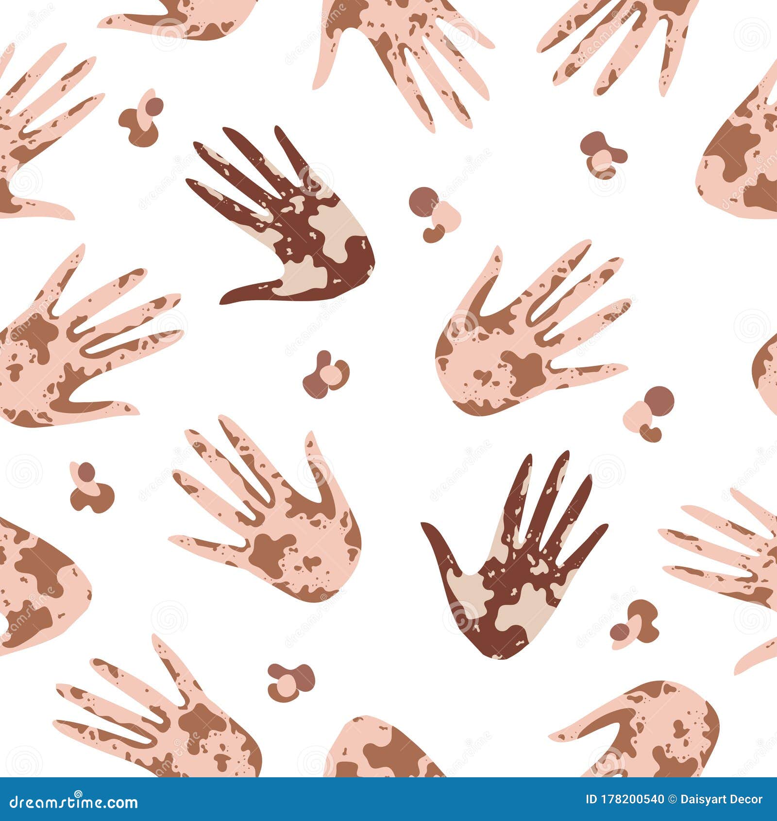 Vitiligo Seamless Pattern Of Hands High Five Pattern With Hands With