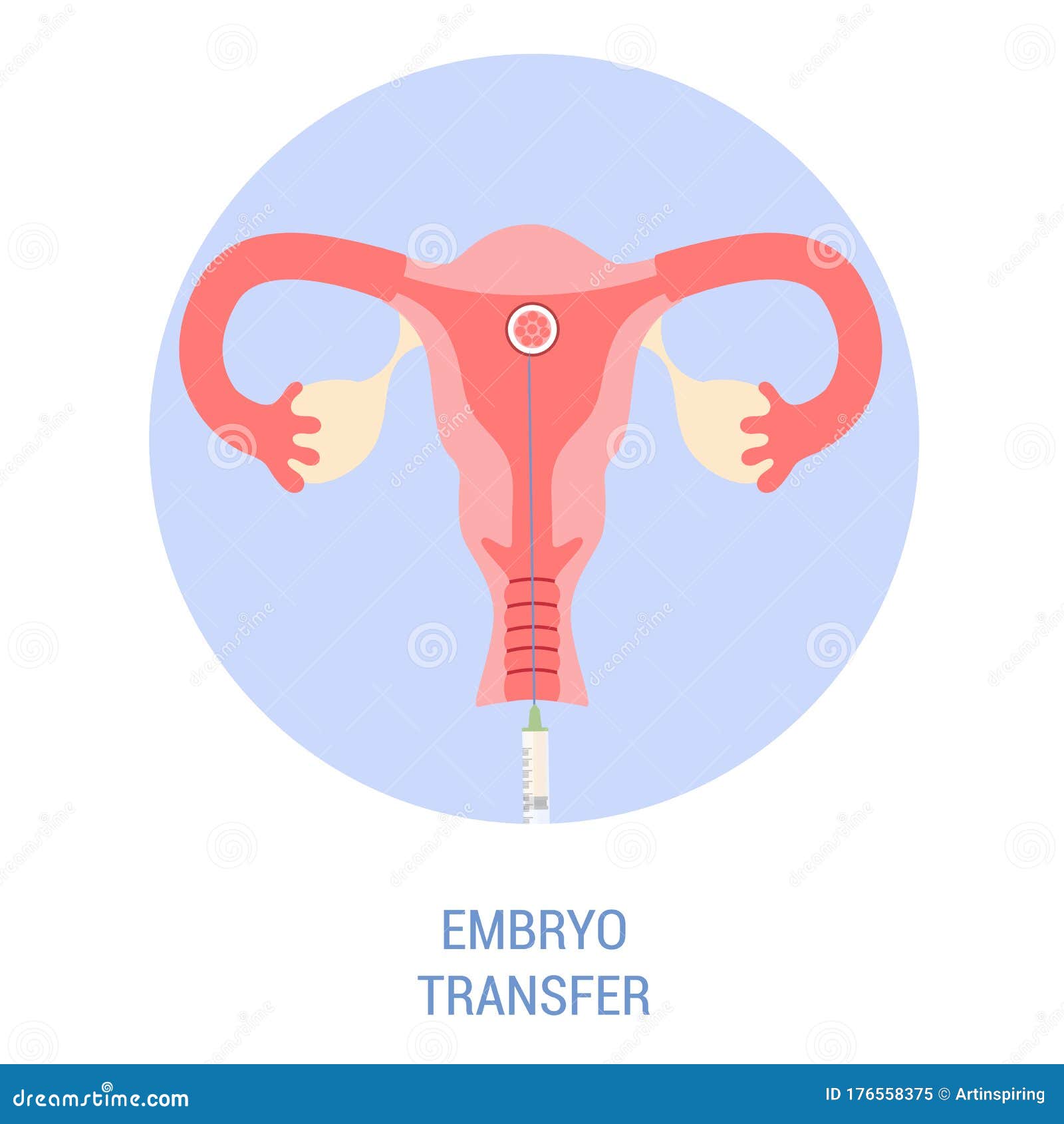 Egg Retrieval And Transvaginal Oocyte Extraction From Ovaries, In Vitro ... Egg Retrieval And Transvaginal Oocyte Extraction From Ovaries, In Vitro ...