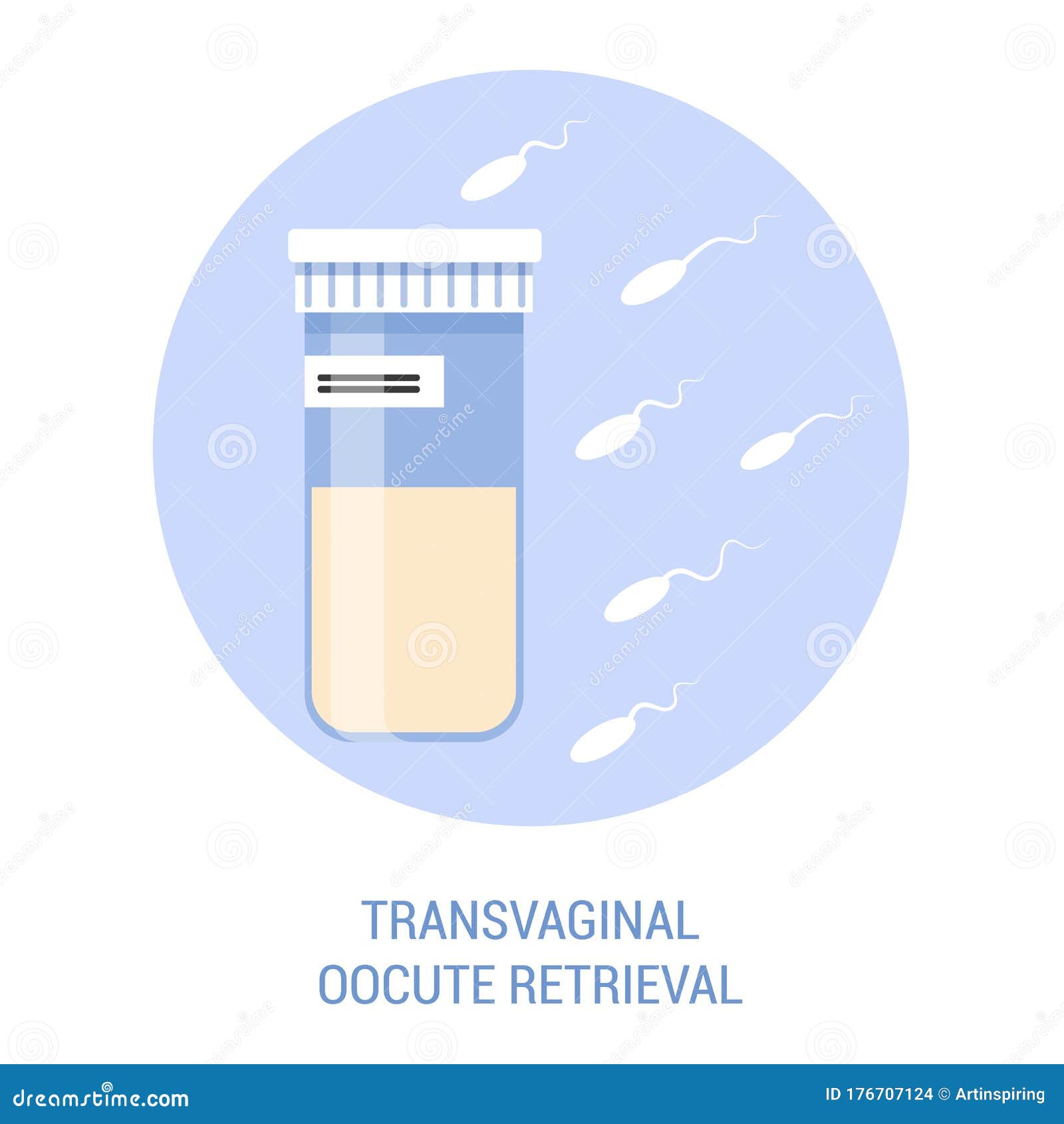Egg Retrieval And Transvaginal Oocyte Extraction From Ovaries, In Vitro ... Egg Retrieval And Transvaginal Oocyte Extraction From Ovaries, In Vitro ...