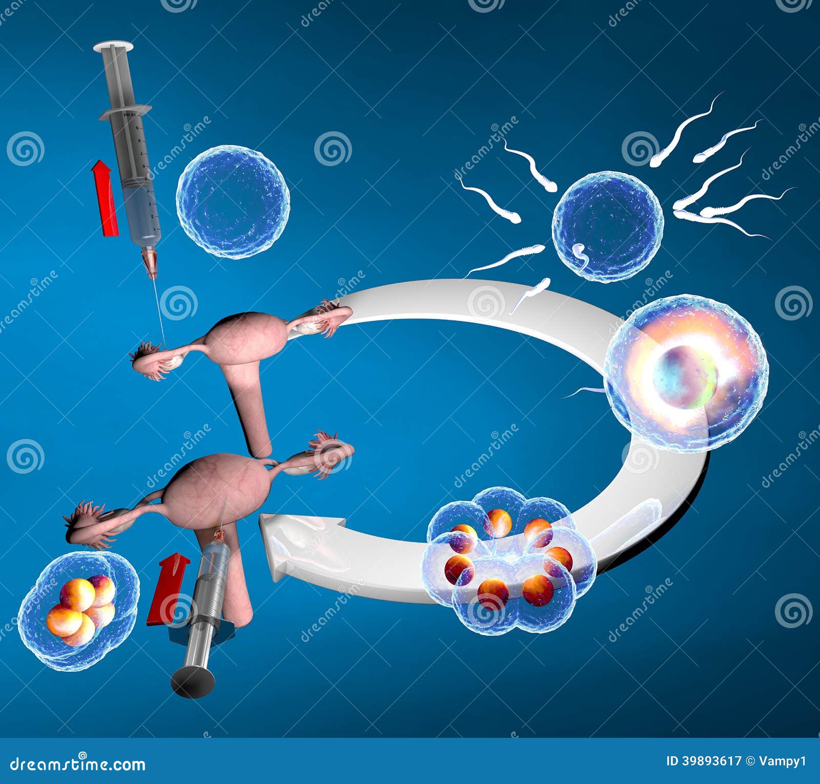 In Vitro Fertilization, Artificial Insemination Route Stock ...