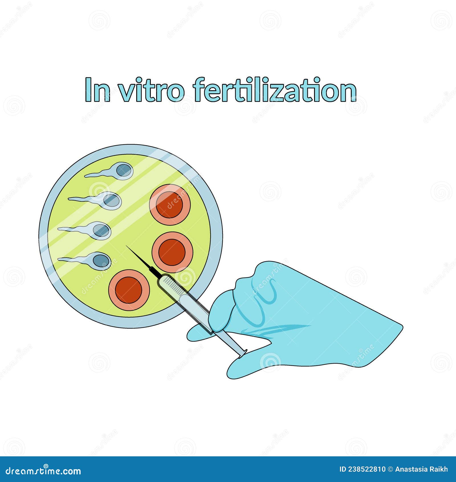 In Vitro Fertilization. Detailed Infographic Showing Laboratory ... In Vitro Fertilization. Detailed Infographic Showing Laboratory ...