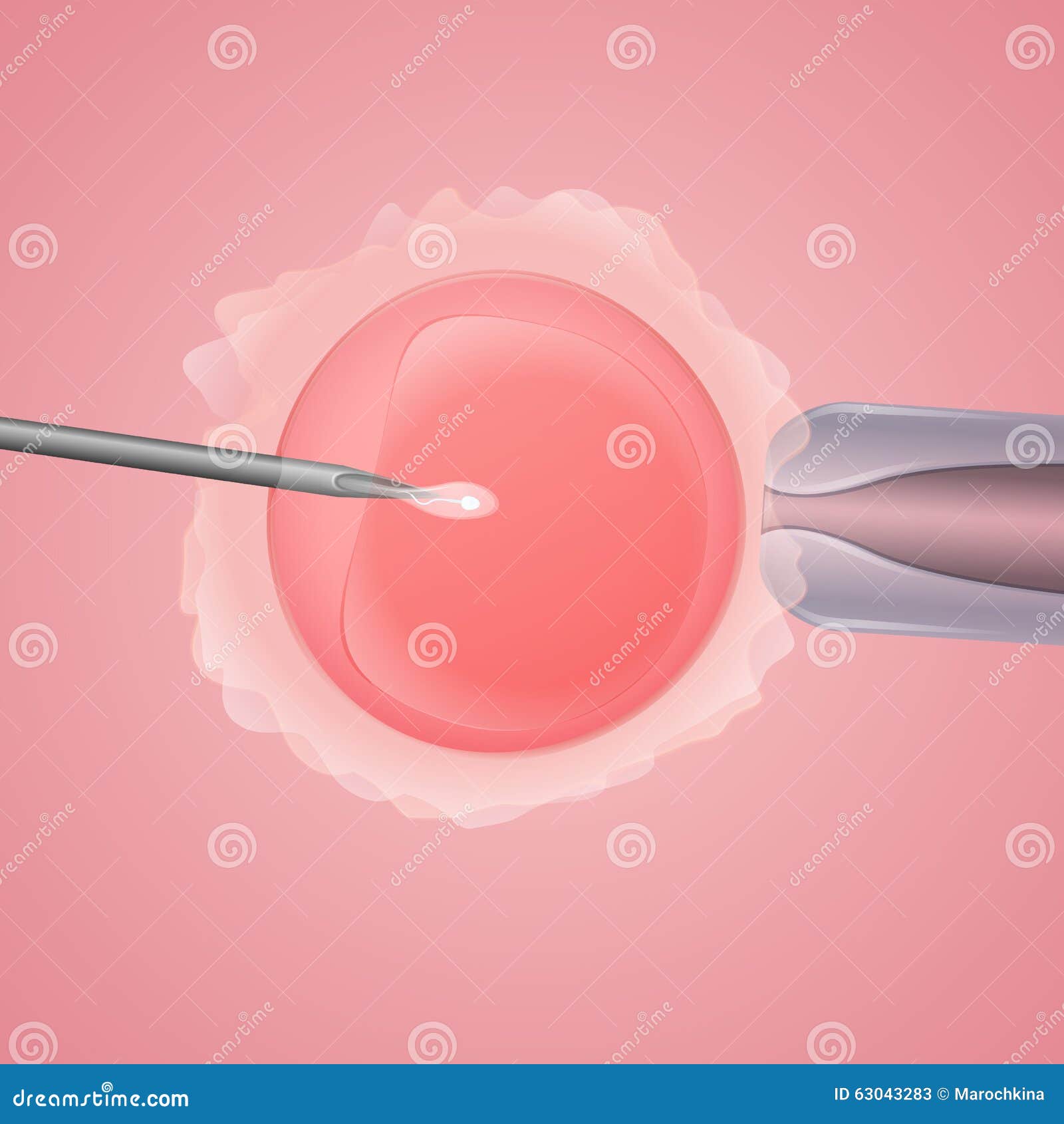 ICSI And IVF In Vitro Fertilization. Vector Illustration ...