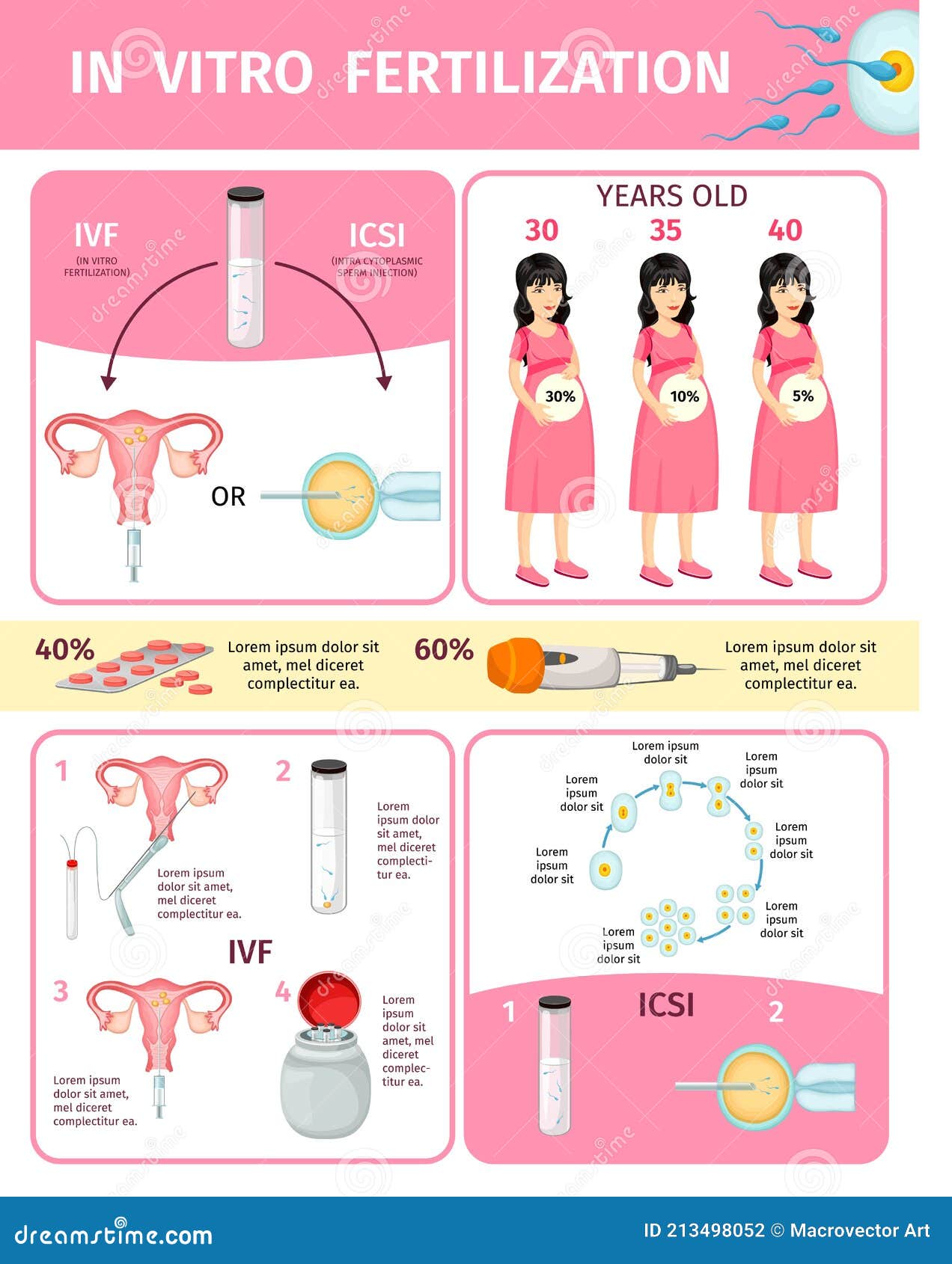 In Vitro Fertilization Infographic Concept Stock Vector - Illustration ...