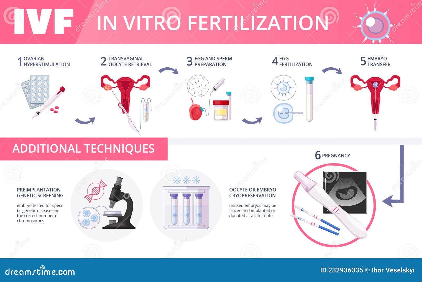 In Vitro Fertilization IVF Flat Infographics Stock Vector ...