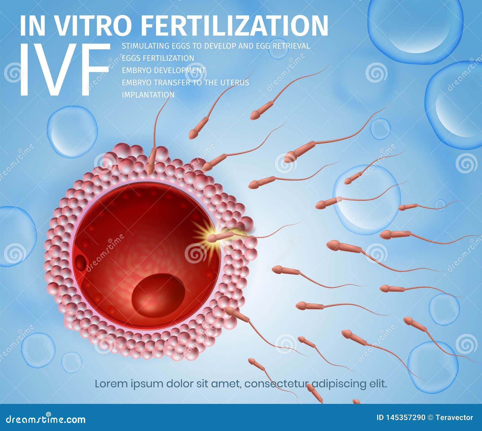 Spermatozoons Cells Flowing Toward Female Egg. Stock Vector ... Spermatozoons Cells Flowing Toward Female Egg. Stock Vector ...