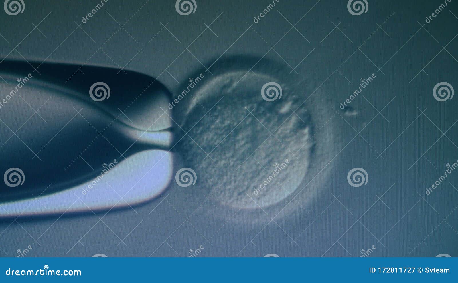 In Vitro Fertilization Under a Microscope. Stock Video - Video of ...