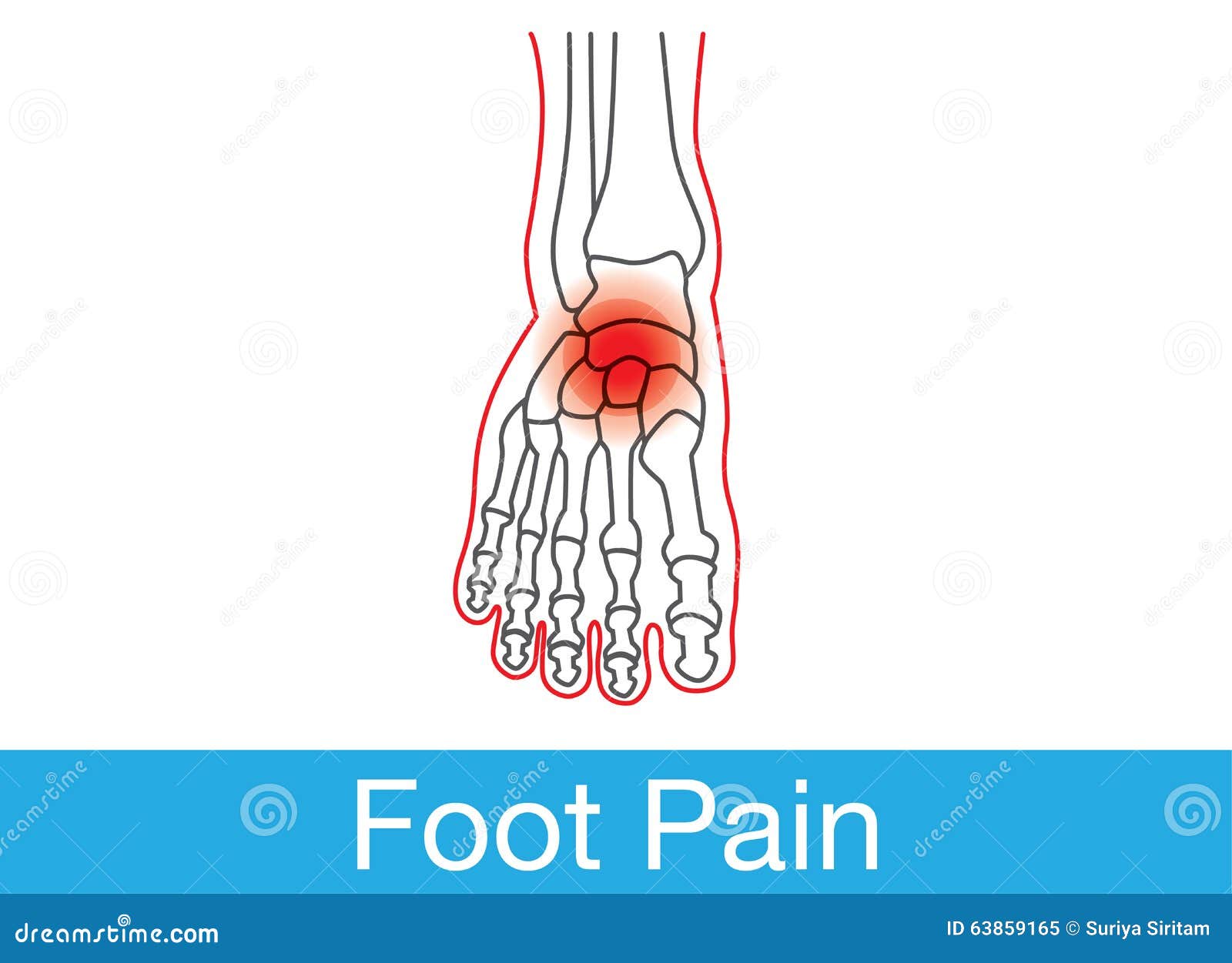 Voetpijn vector illustratie. Illustration of gezondheid - 63859165