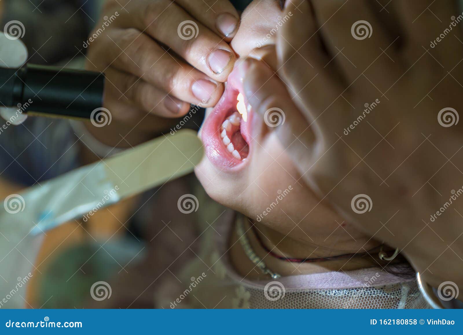 Volunteer Nurse Performing Medical Examination on Poor Asian Children ... Volunteer Nurse Performing Medical Examination on Poor Asian Children ...