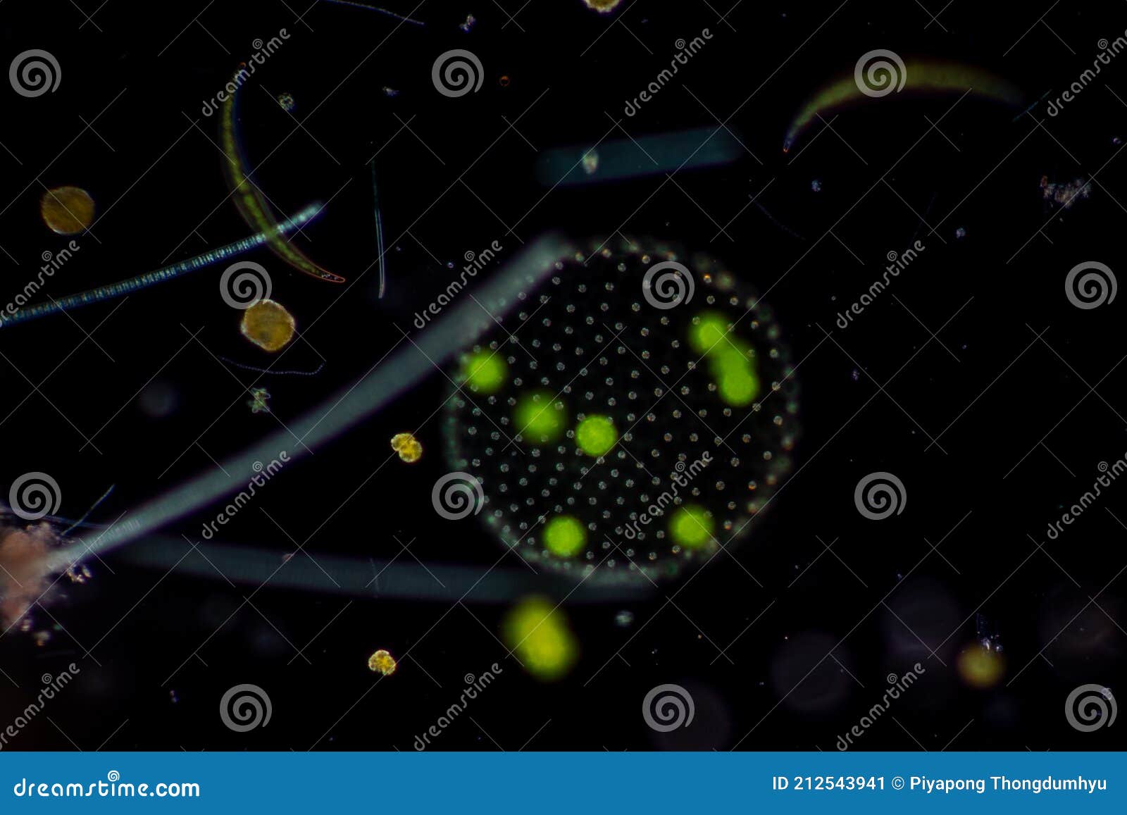 Volvox In Drop Of Water Under The Microscope. Stock Photo ...