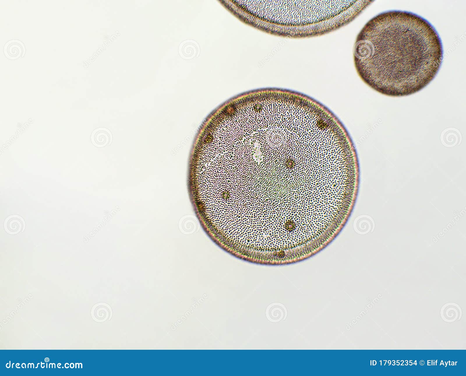 Volvox Under Microscope