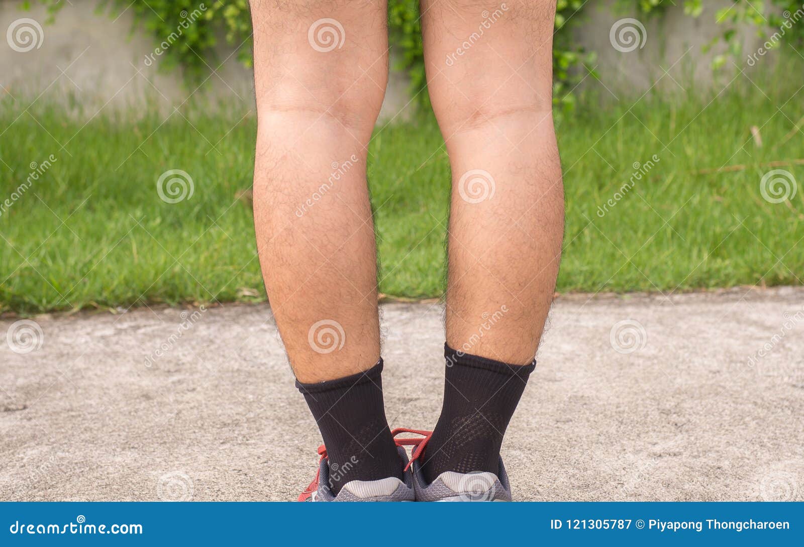 Vorm De Met O-benen Van Het Mensenbeen Van De Benen, Selectieve Nadruk ...