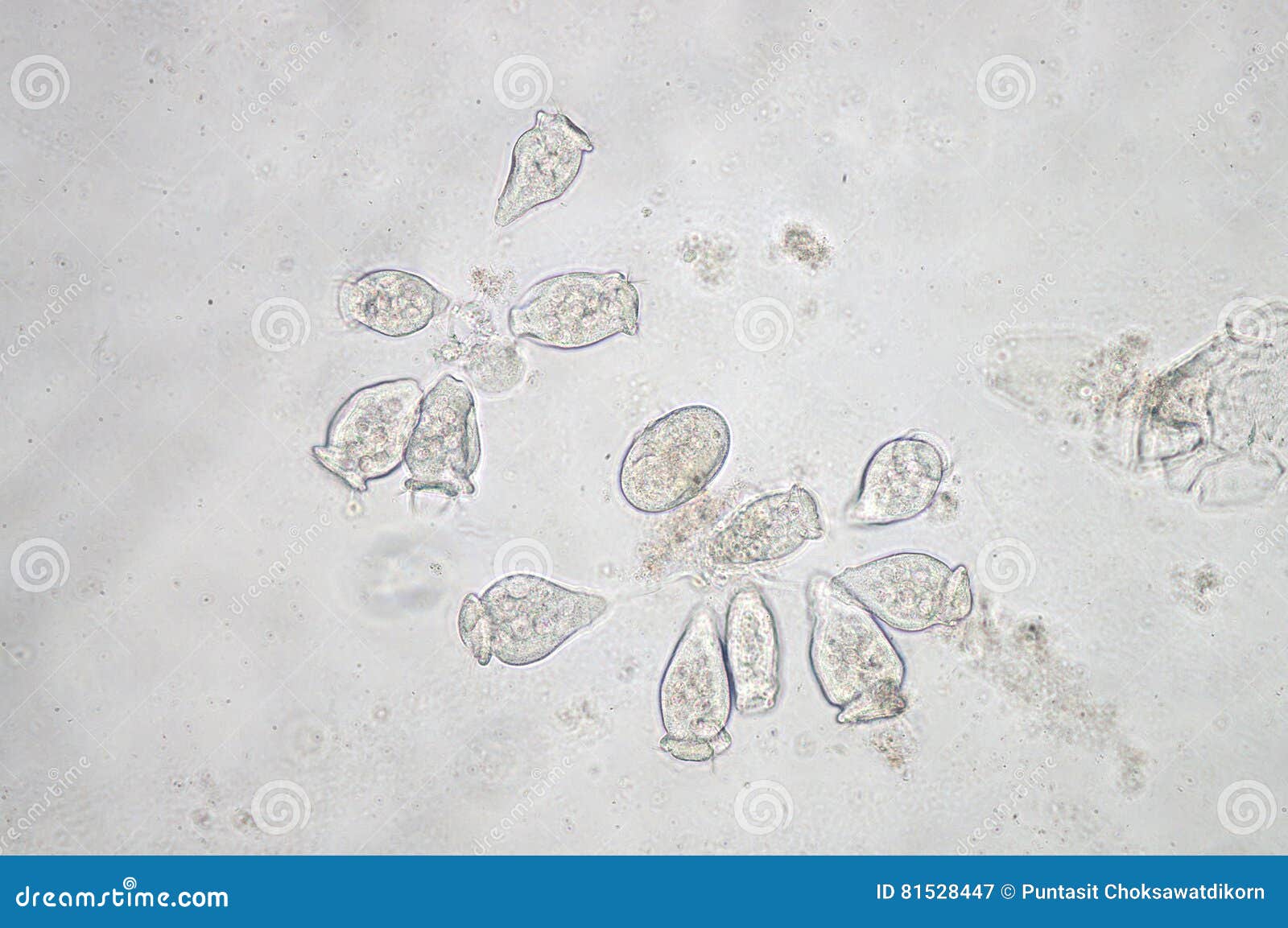 Freshwater Vorticella Campanula By Microscope. Benthos. Zooplankton ...