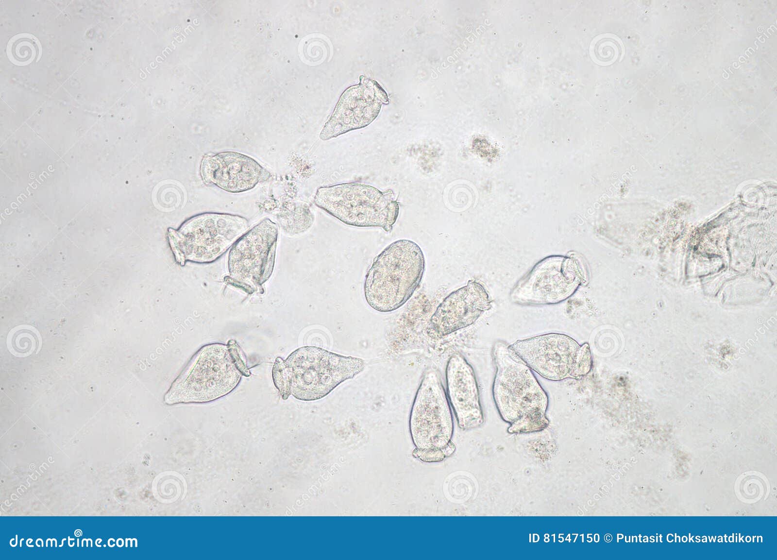 Vorticella is a Genus of Protozoan Stock Illustration - Illustration of ...