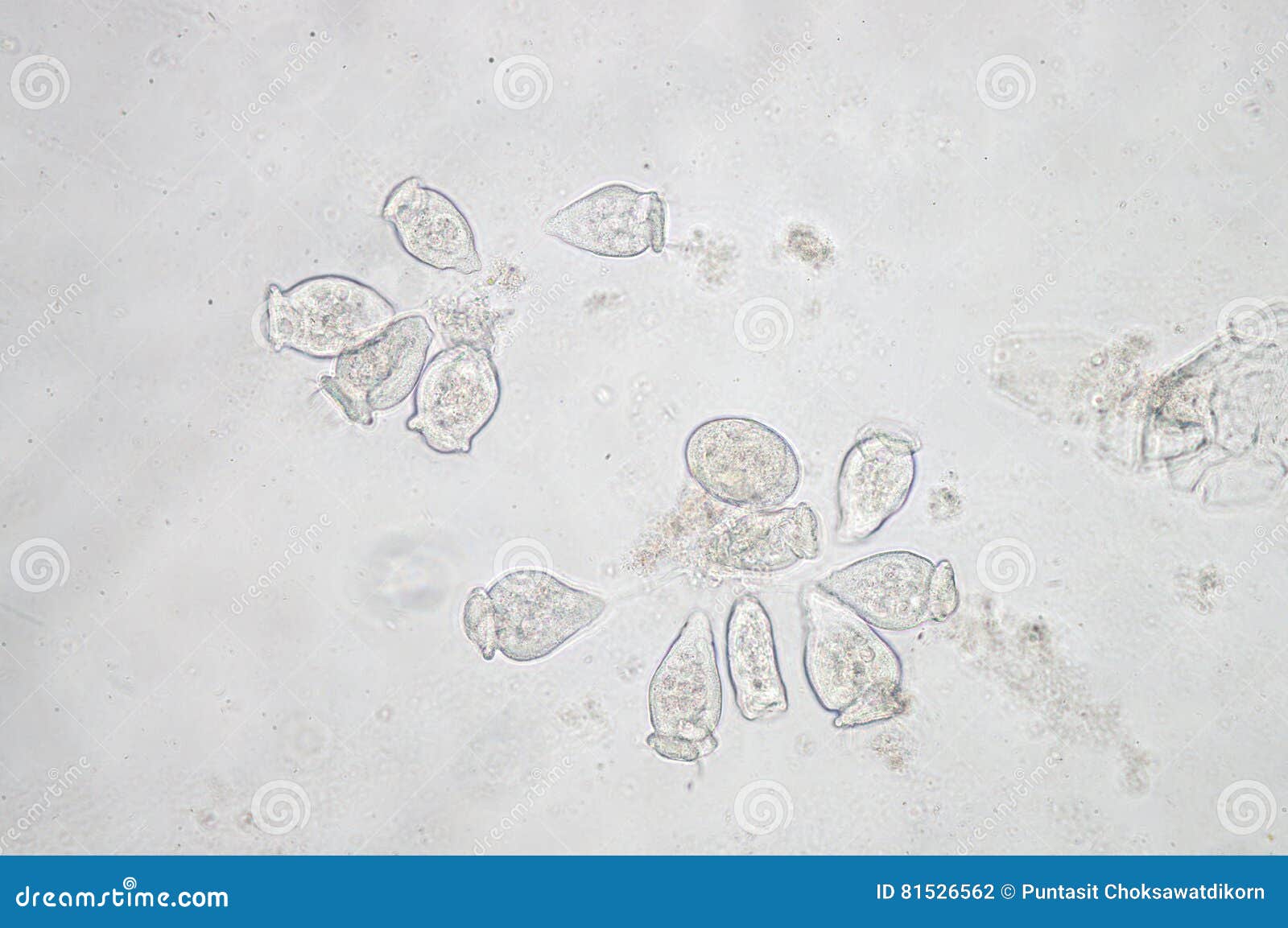 Vorticella Ist Eine Klasse Der Protozoon Stockfoto - Bild von ...