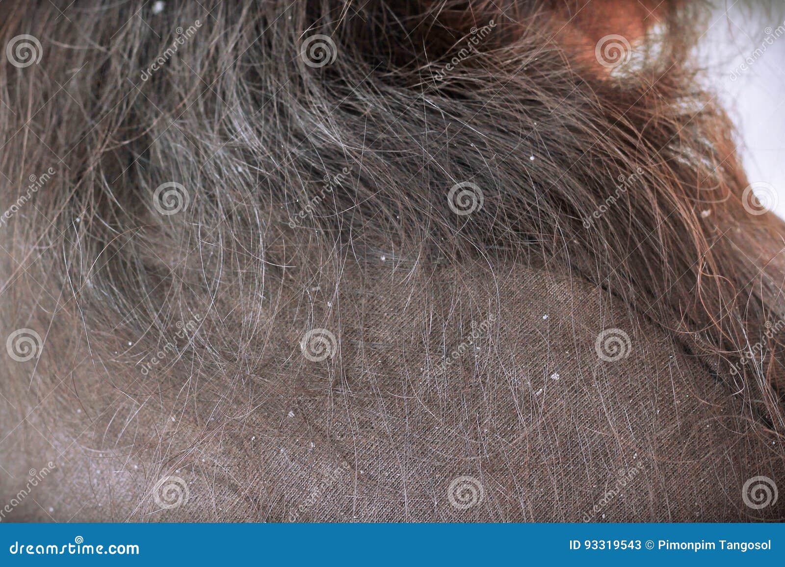 Vrouwen Die Hoofdroos Hebben Stock Afbeelding - Image of sociaal, roes ...