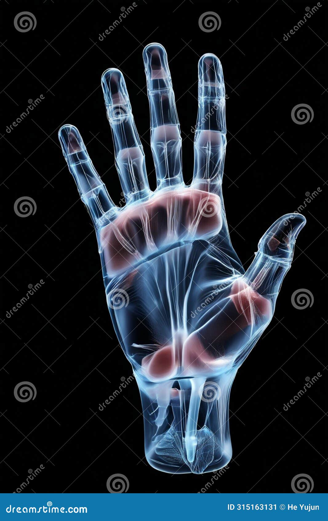 Walking Skeleton: X-ray Style 3D Illustration of Human Lower Limbs ...