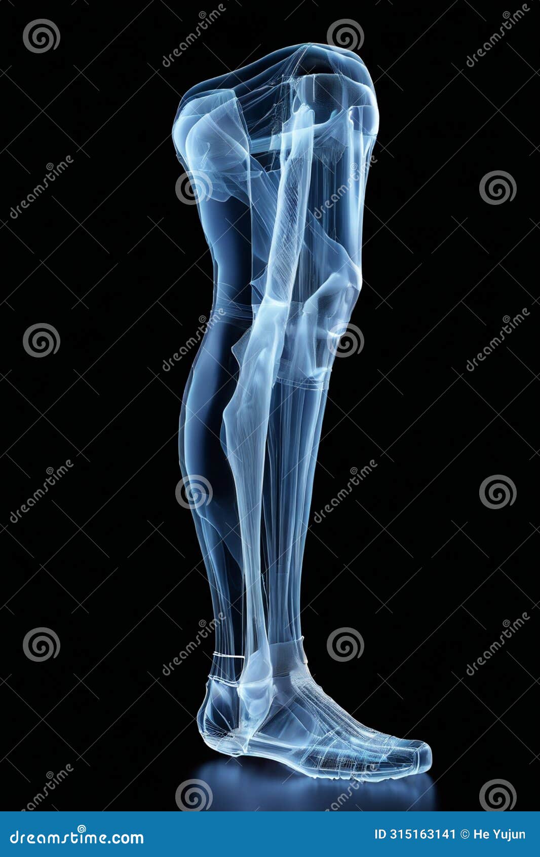 Walking Skeleton: X-ray Style 3D Illustration of Human Lower Limbs ...