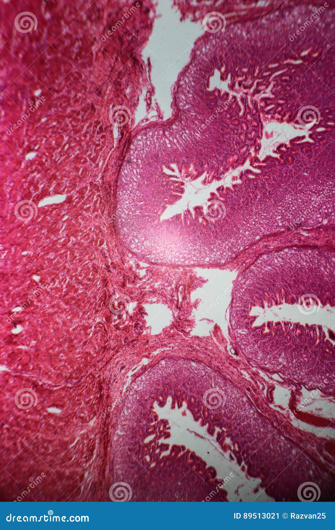 Wall of Stomach Section Under the Microscope Stock Image - Image of ...