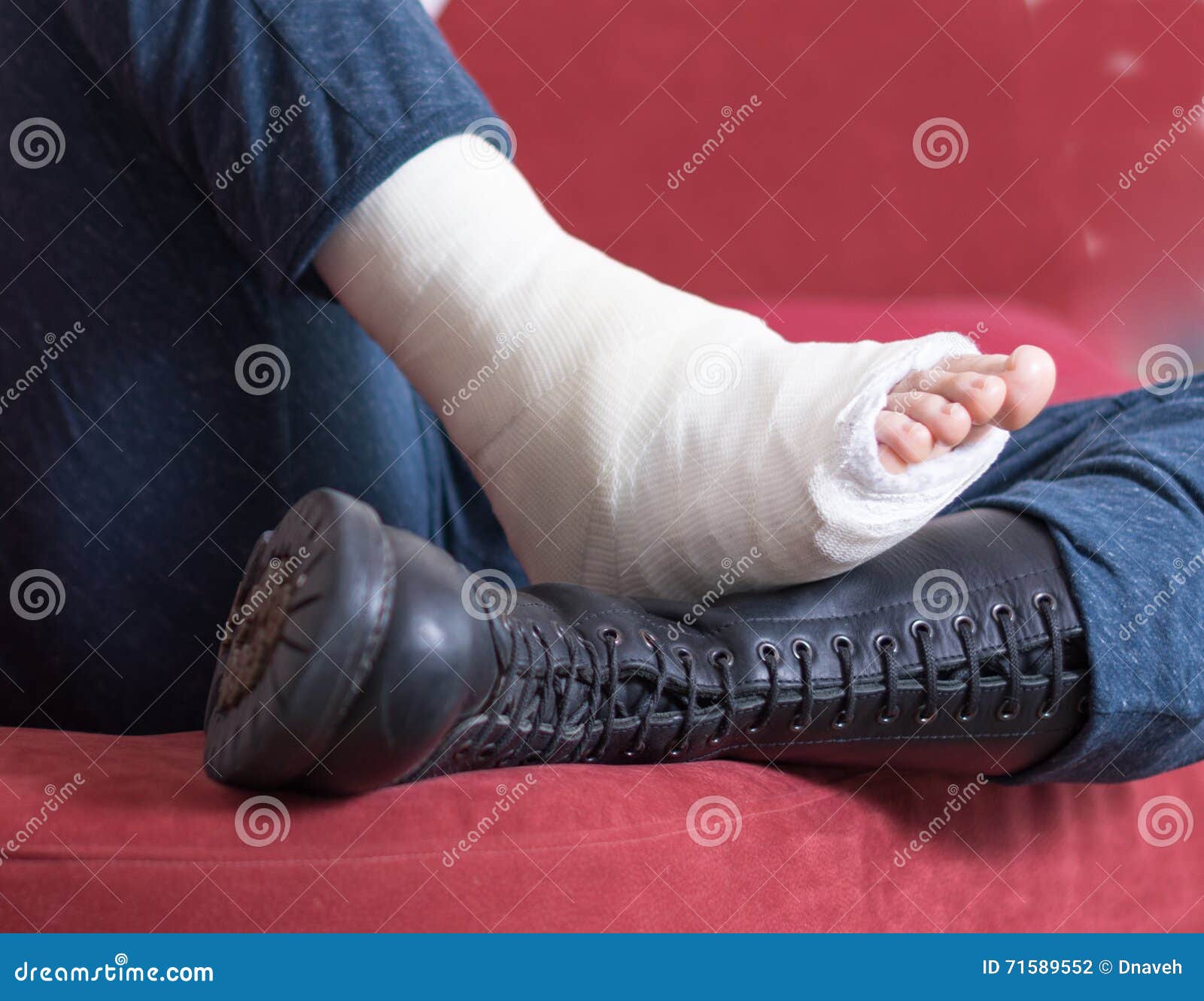 War and Injury - Cast and Combat Boot Concept Stock Photo - Image of ...