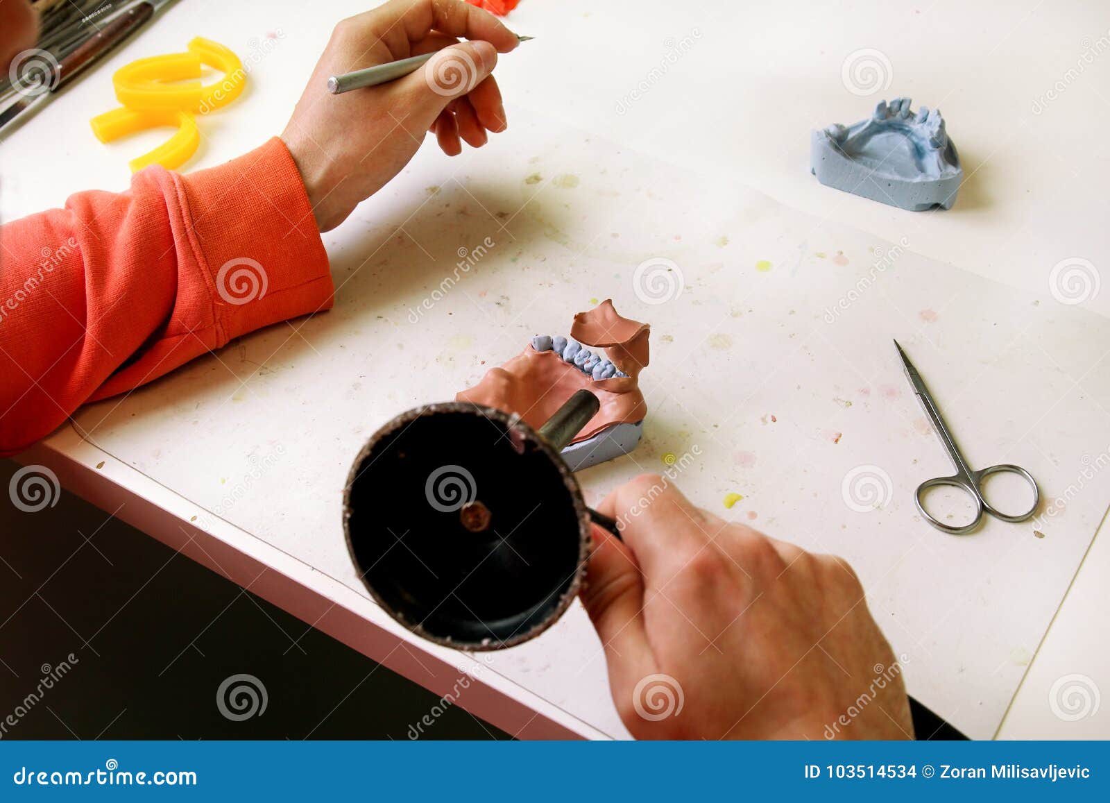 Warming of Shellac Base Plates Over the Plaster Model Stock Photo ...