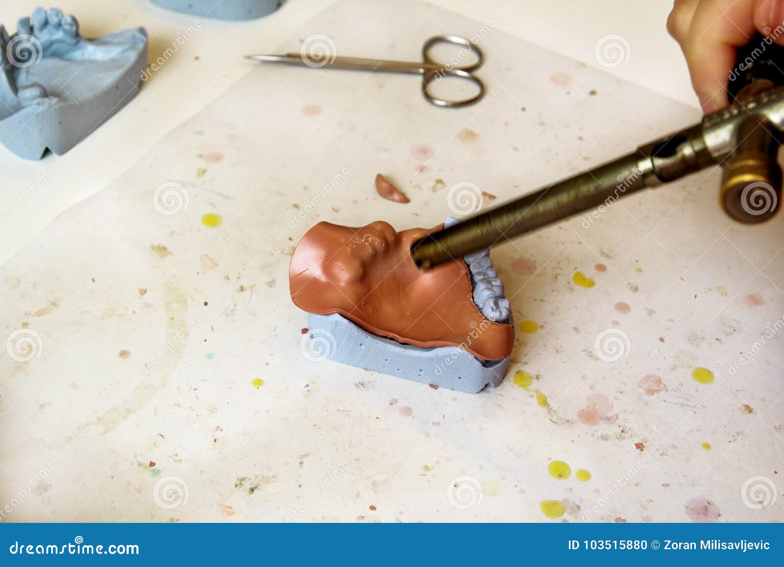 Warming Of Shellac Base Plates Over The Plaster Model Royalty-Free ...