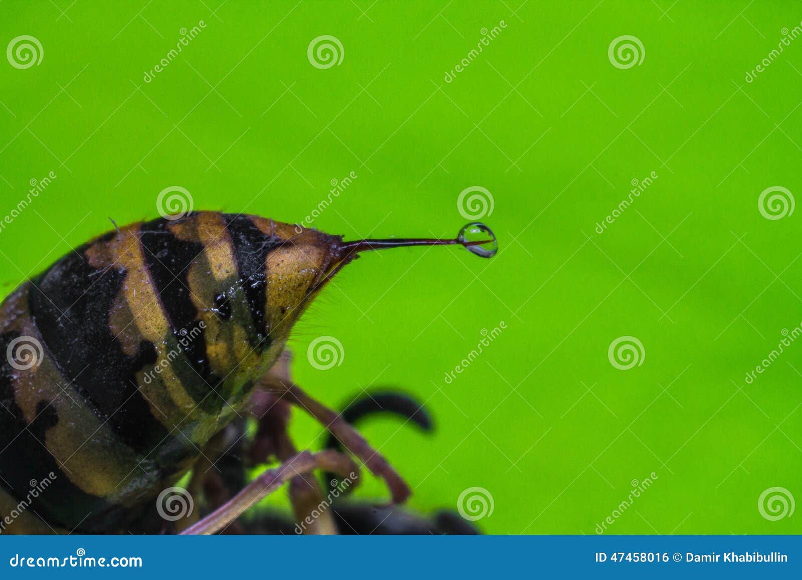Wasp Sting Human. Close Up Detailed With Magnifier Pathogenesis Of Bee ...