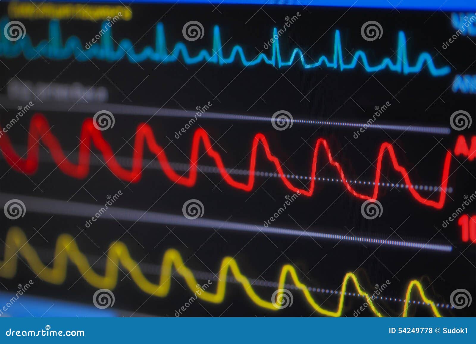 Waves ECG on Monitor in Perspective Stock Photo - Image of heart ...