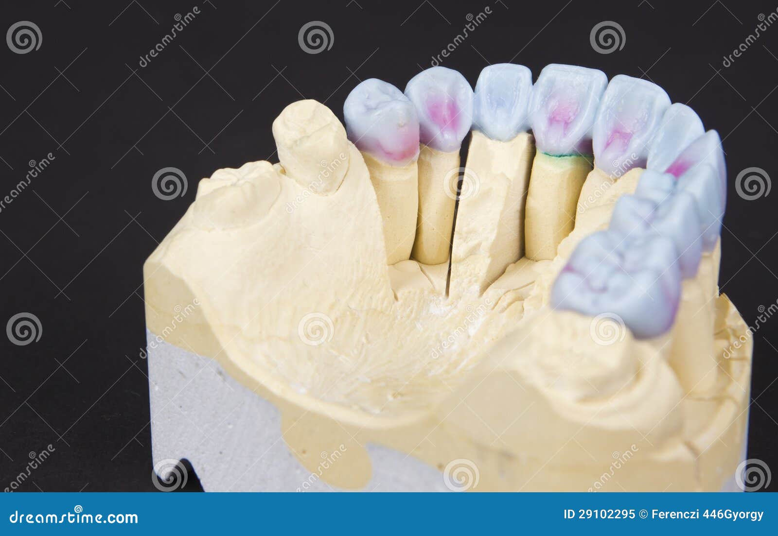 Wax denture stock image. Image of model, prosthetic, artificial - 29102295