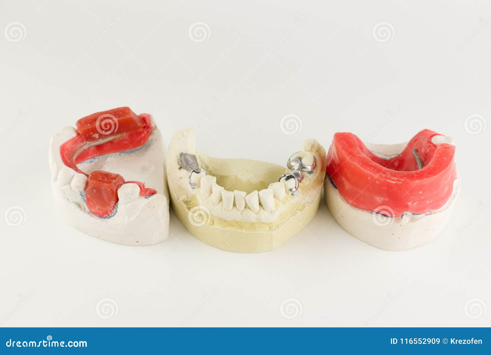 Wax Rollers on the Tooth Model Stock Image - Image of plaster ...