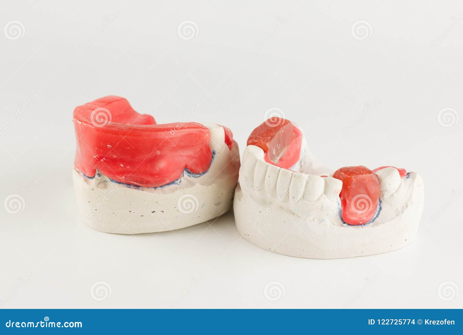 Wax Rollers on the Tooth Model Stock Photo - Image of prosthetic, mold ...