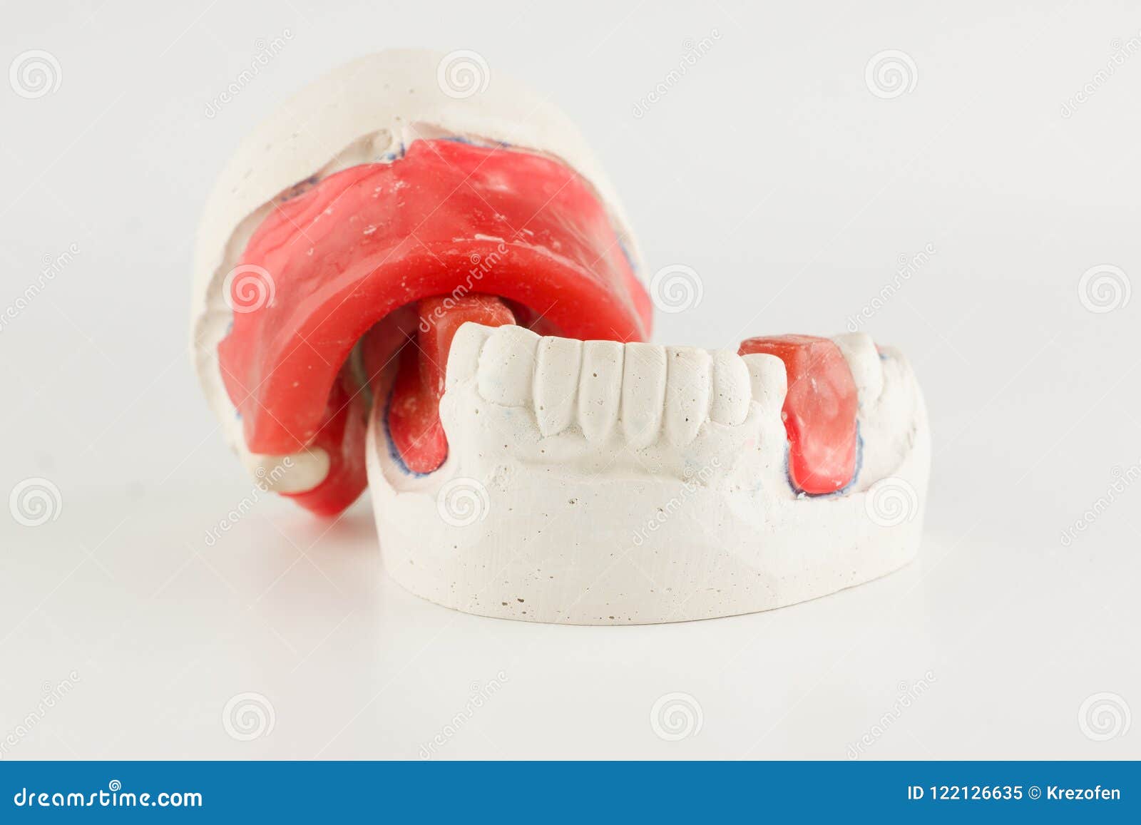 Wax Rollers on the Tooth Model Stock Image - Image of denture, dentist ...