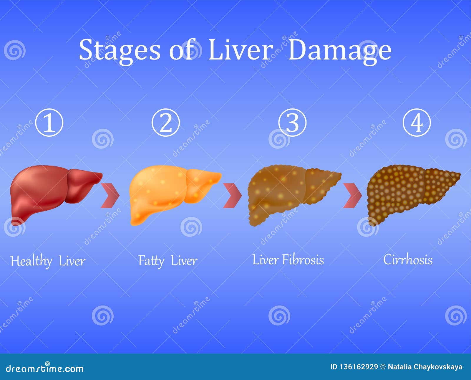 Stages Of Liver Damage. The First Symptoms Of Liver Problems Are ... Stages Of Liver Damage. The First Symptoms Of Liver Problems Are ...