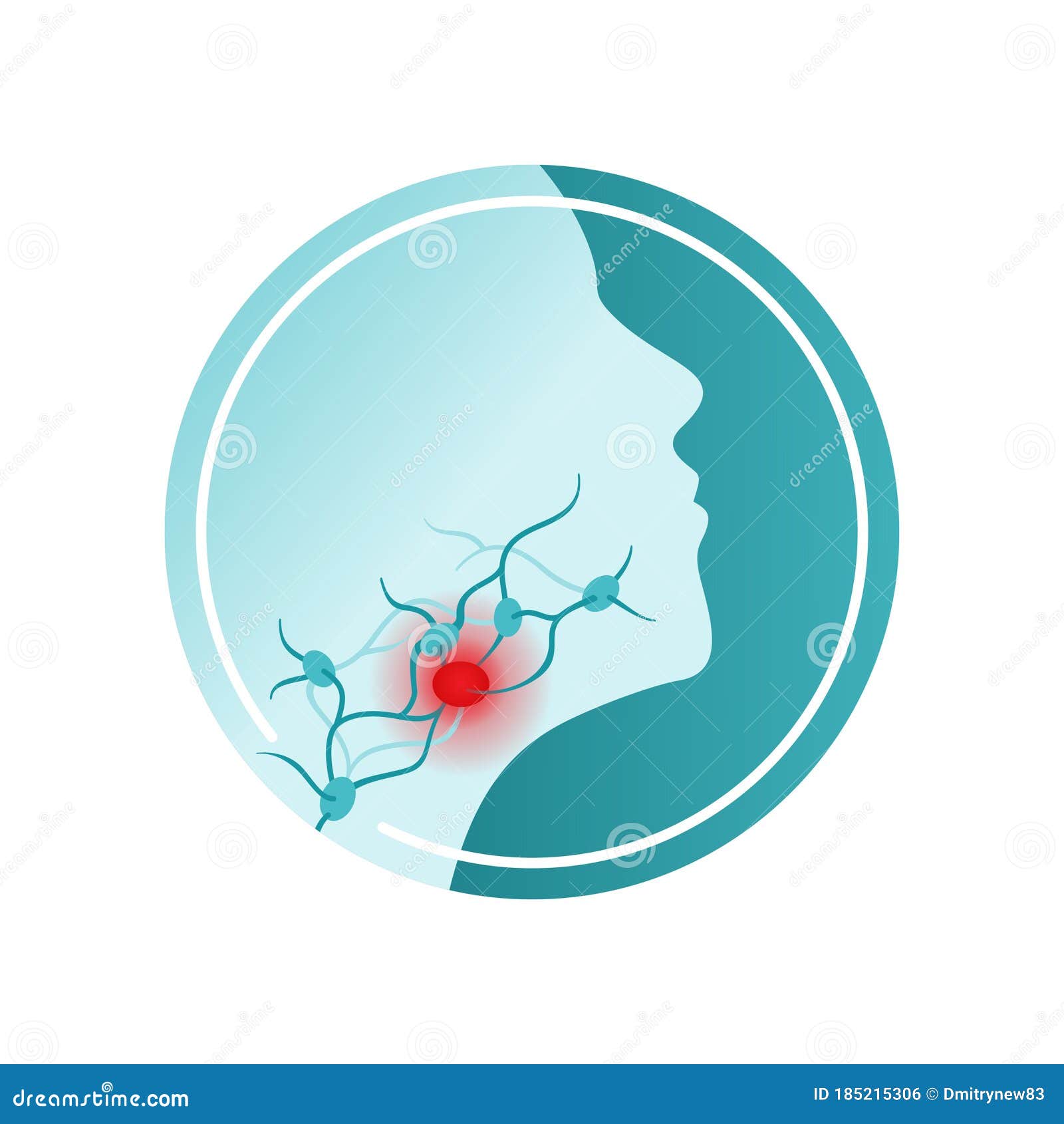 Lymphonodus inflammation stock vector. Illustration of pain - 185215306