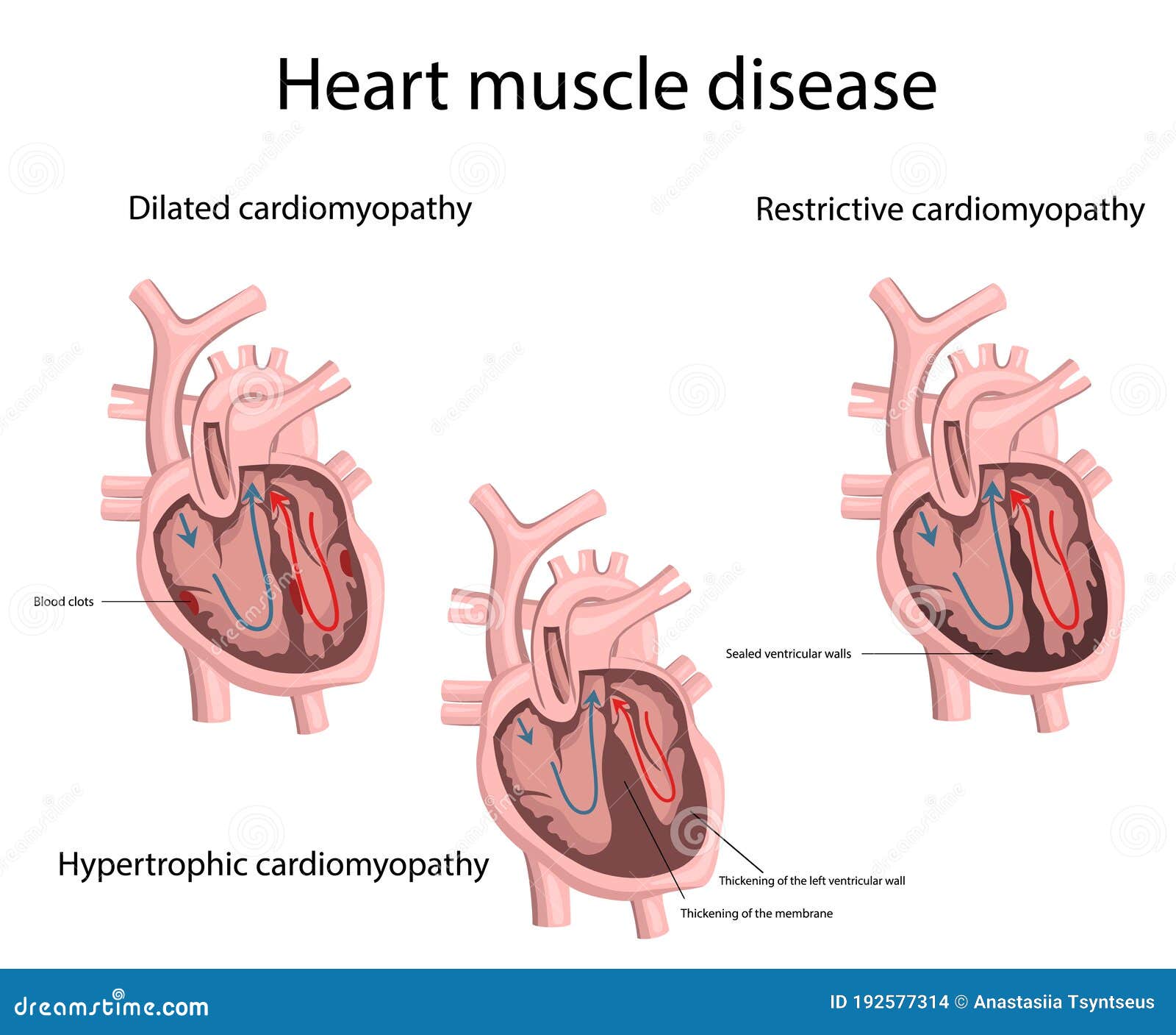 Heart Muscle, Light Micrograph Royalty-Free Stock Photo | CartoonDealer ...
