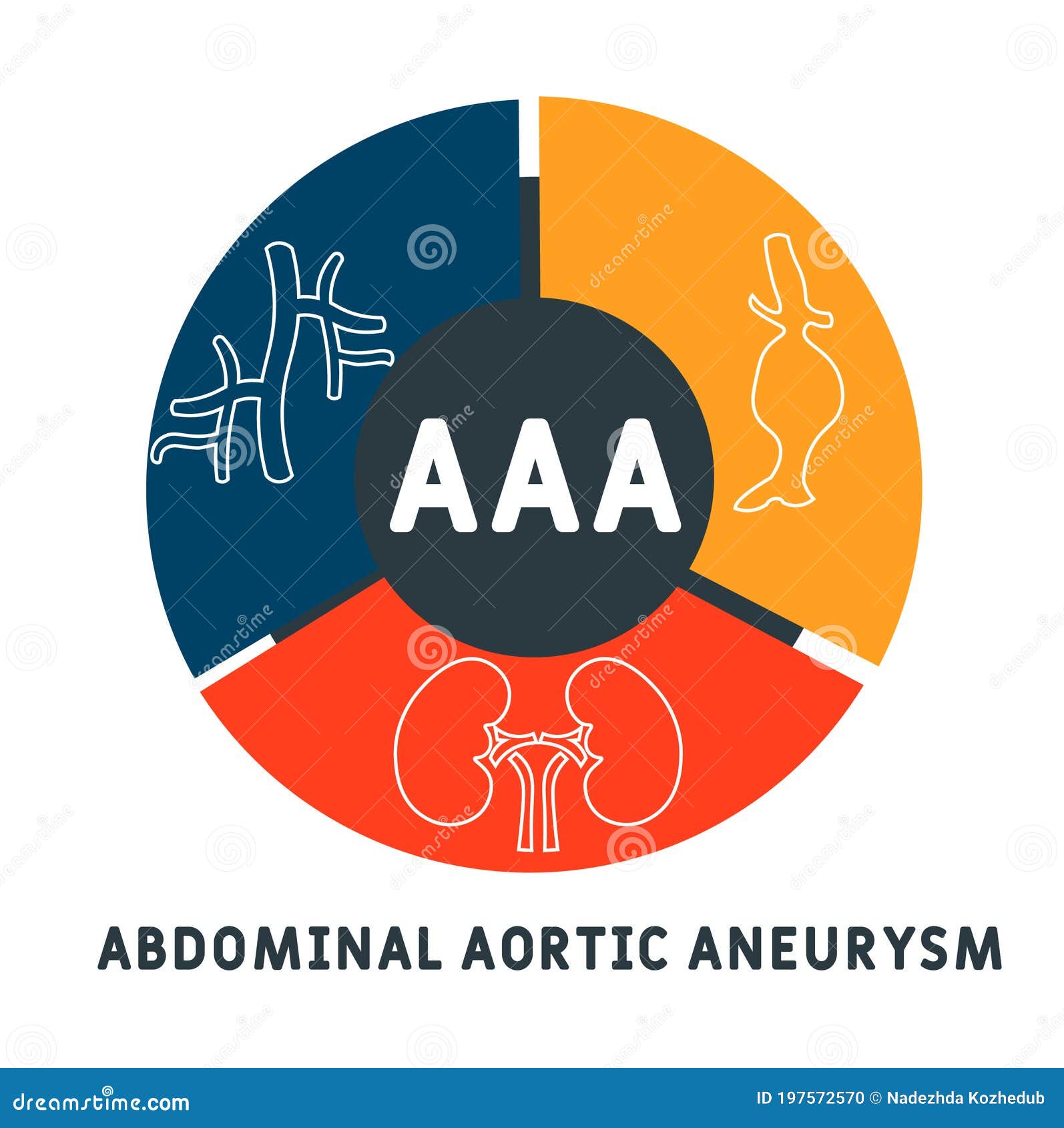 AAA - Abdominal Aortic Aneurysm Acronym, Medical Concept Background ...