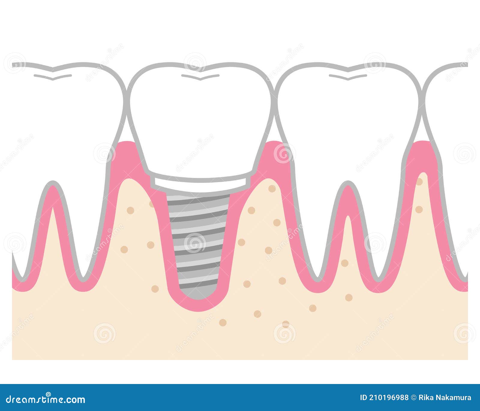 Metal Treated Grayscale Cavity Map Texture Stock Photography ...