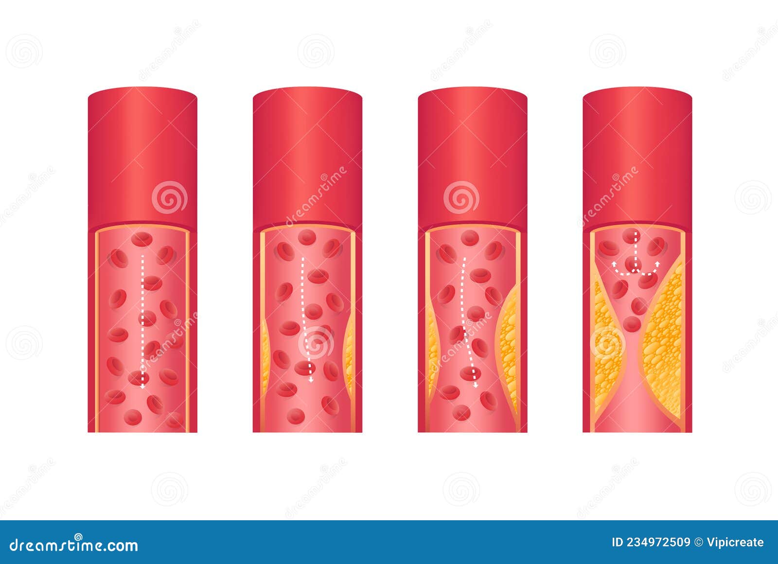 Stages Of Formation Of MRNA RNA And Protein By DNA Strand Infographic ...