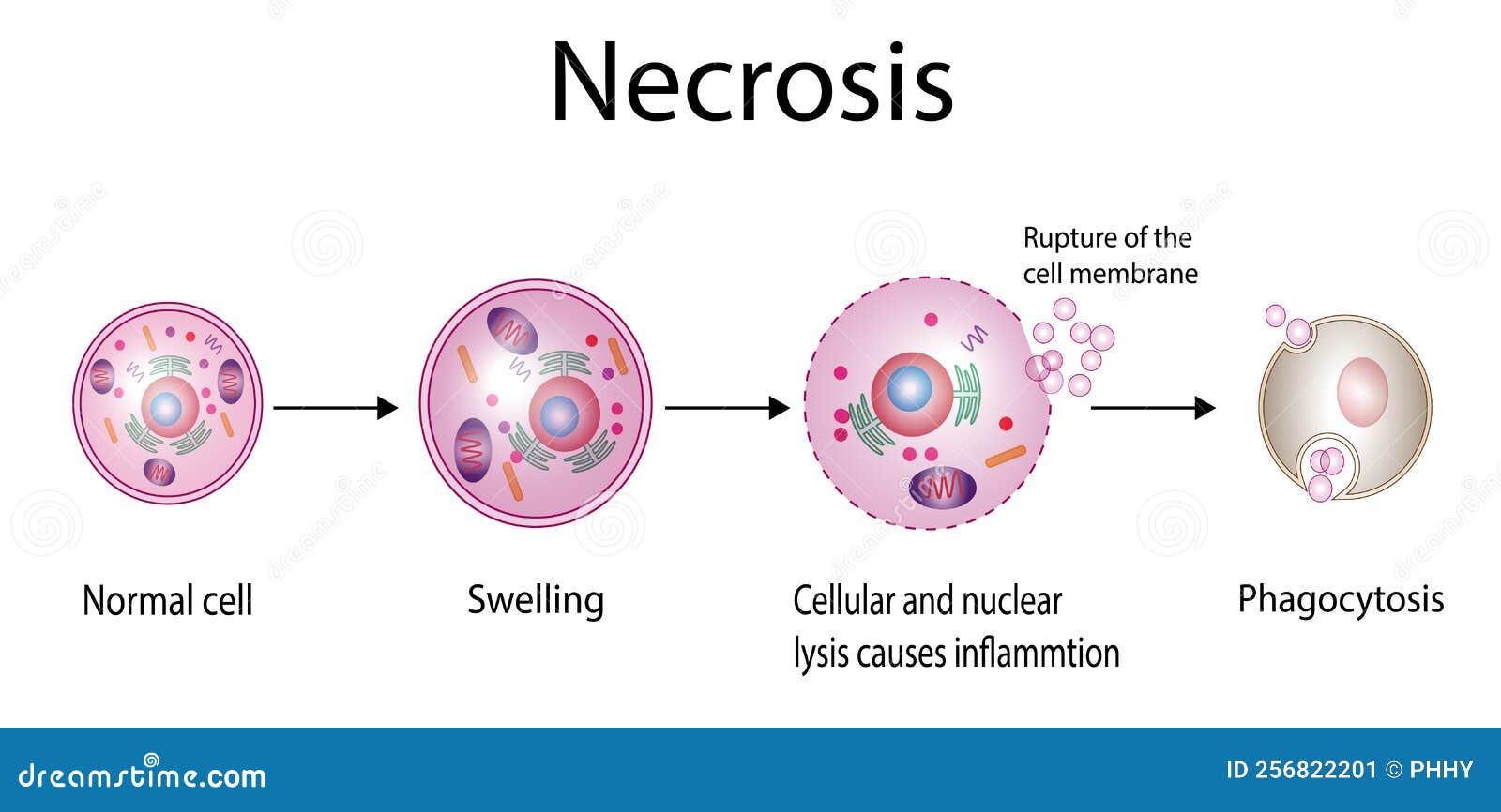 Necrosis, Pathologic Cell Death. Stock Vector - Illustration of dead ...