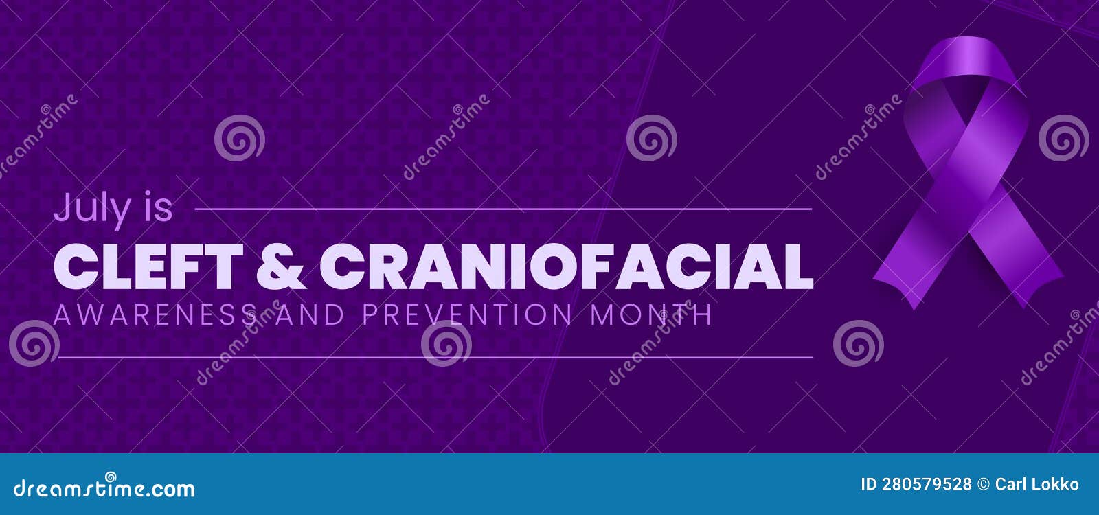 Cleft Lip And Cleft Palate. Vector Art, Illustration. | CartoonDealer ...