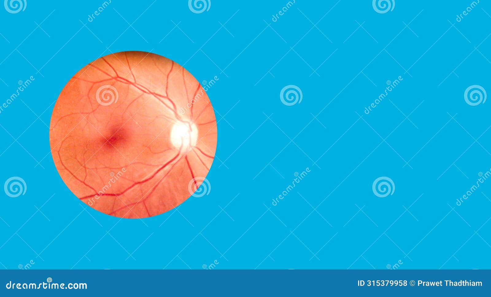 Patient Elderly with Retina of Diabetes.Human Eye Anatomy Taking Images ...
