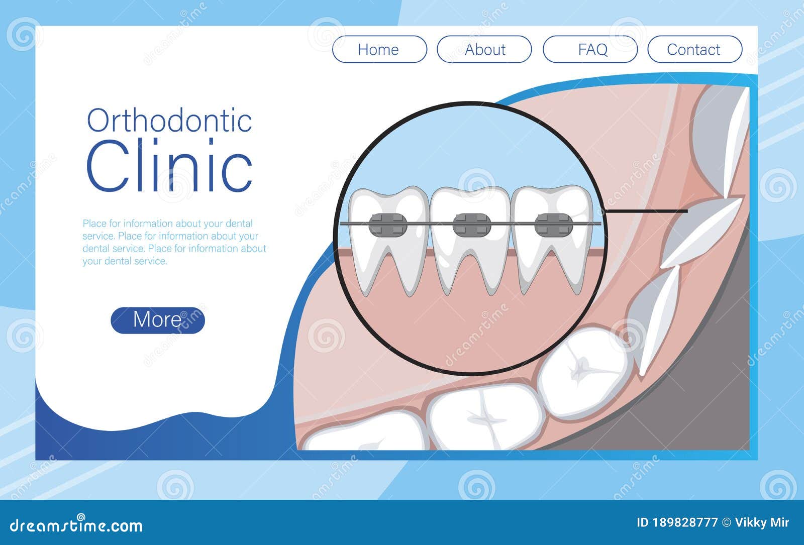 A Top View Of Molars And Incisors On The Jaw Caries Before Visiting The ...